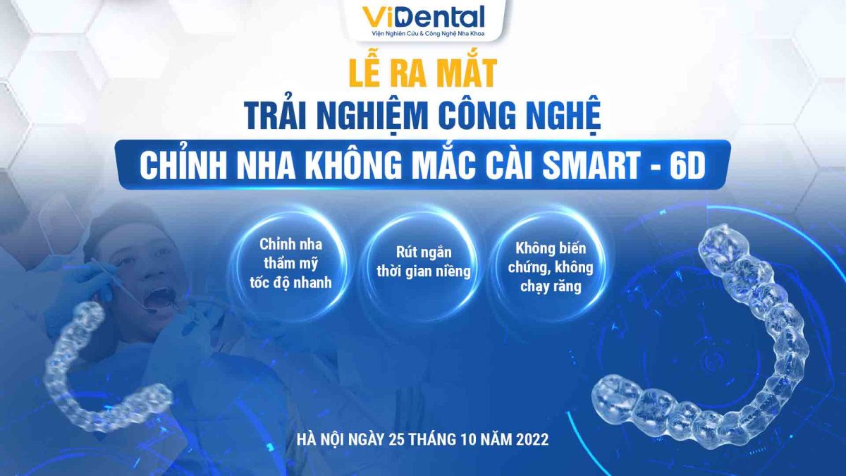 Lễ Ra Mắt Công Nghệ Chỉnh Nha Không Mắc Cài Smart - 6D