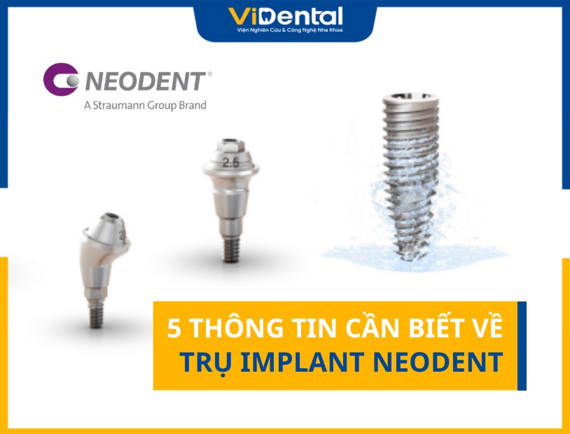Trụ Implant Neodent Có Ưu - Nhược Điểm Gì? Giá Bao Nhiêu?