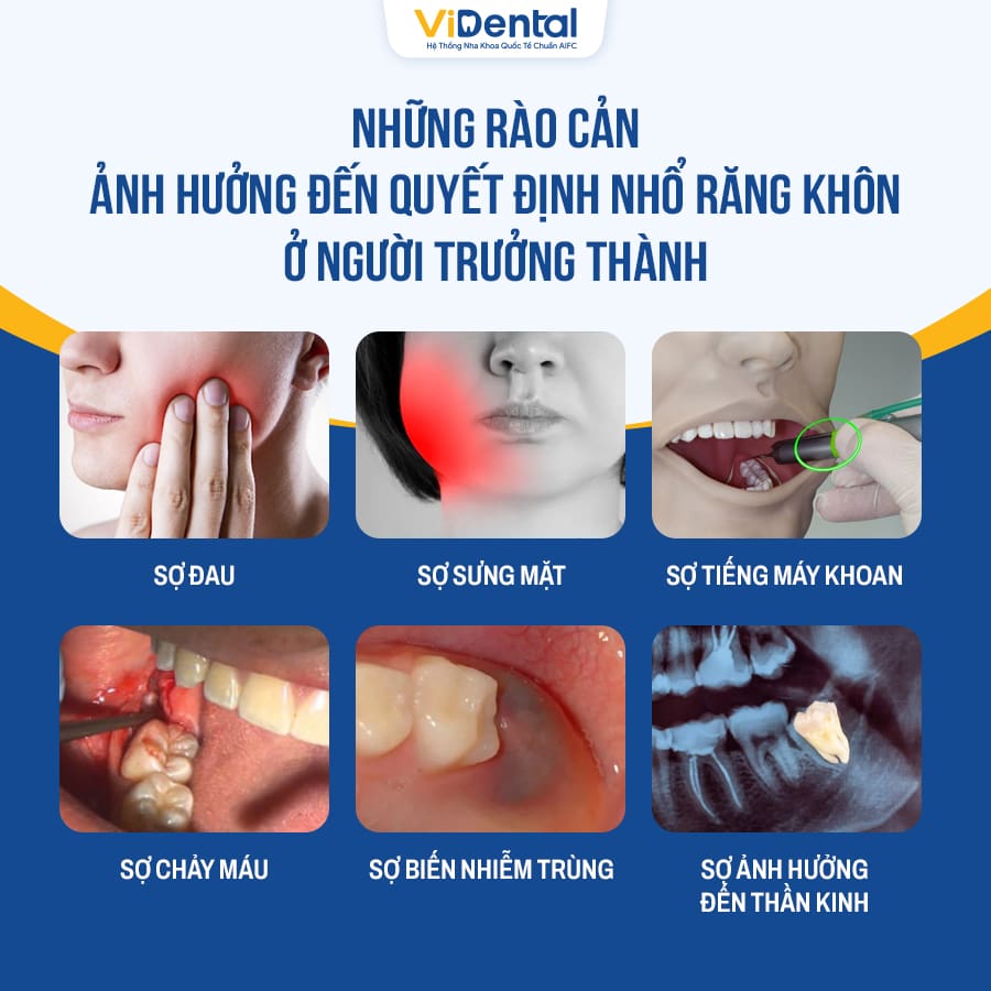 Nhổ Răng Khôn Ít Đau - Xâm Lấn Tối Thiểu Cùng Bác Sĩ Quang Anh - Nha ...