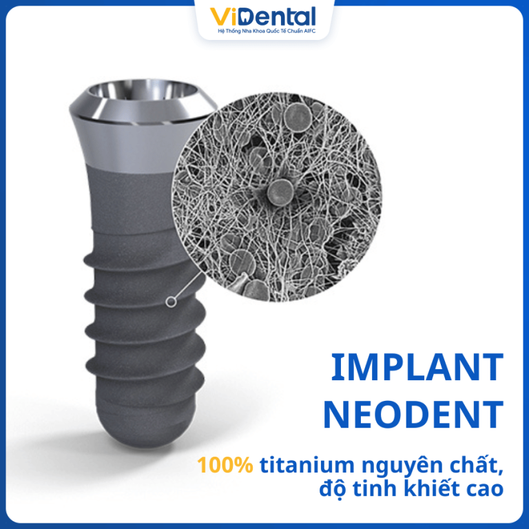 Implant Neodent Có Đặc Điểm Gì Nổi Bật? Giá Bao Nhiêu?