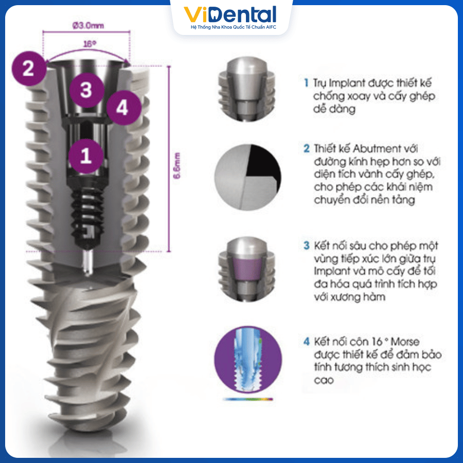 Implant Neodent Có Đặc Điểm Gì Nổi Bật? Giá Bao Nhiêu?