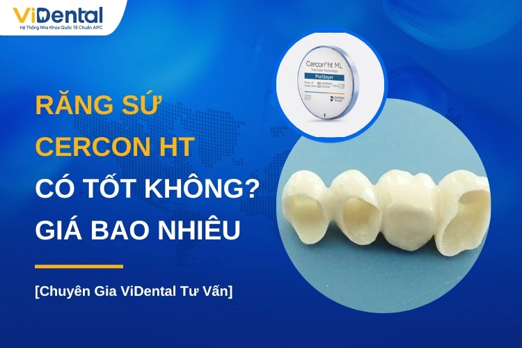 Răng sứ Cercon HT: Tổng Quan, Ưu Điểm Nổi Bật Và Chi Phí Mới Nhất
