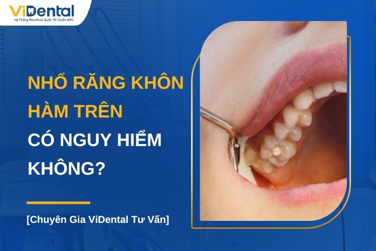 Nhổ Răng Khôn Hàm Trên Có Nguy Hiểm Không?