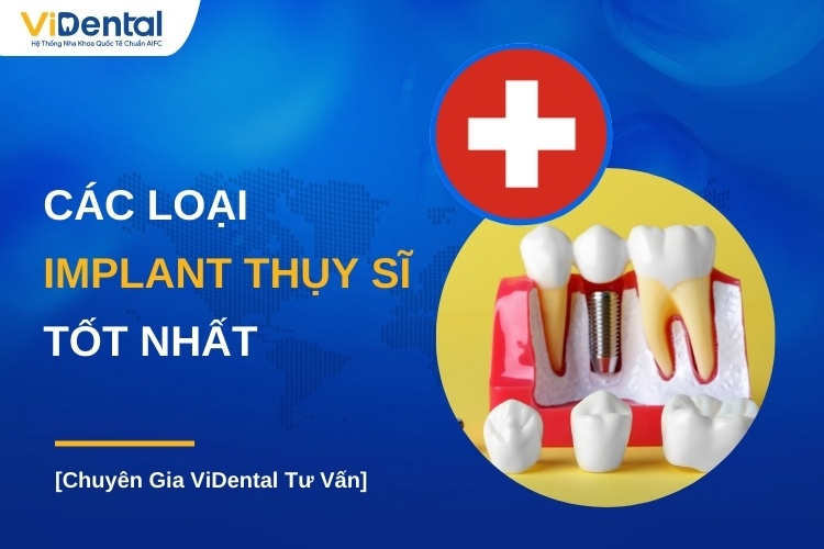 Trụ Implant Thụy Sĩ Có Mấy Loại Giá Bao Nhiêu