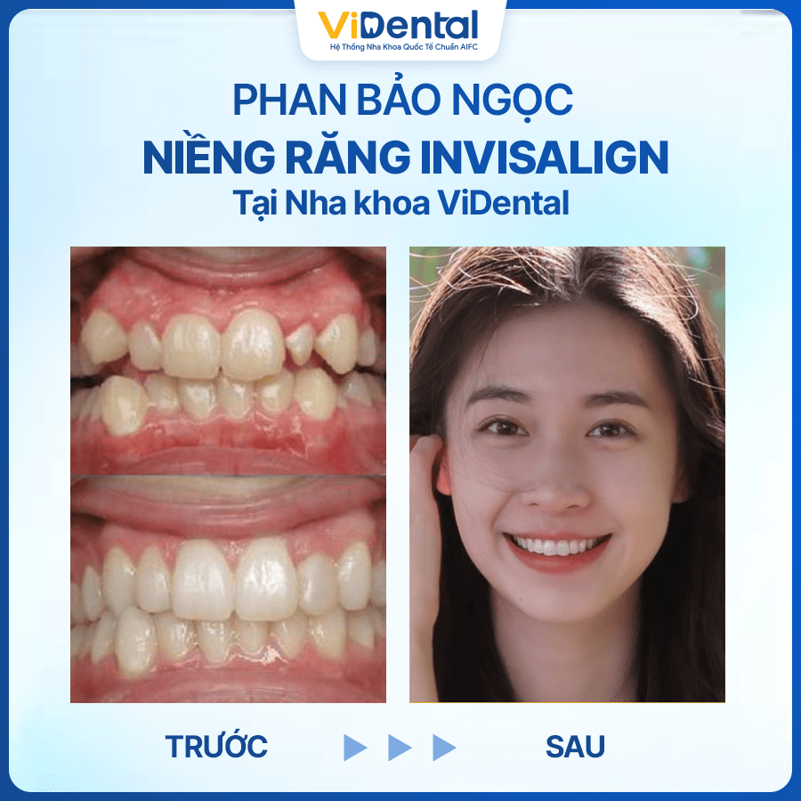 Khách Hàng Phan Bảo Ngọc