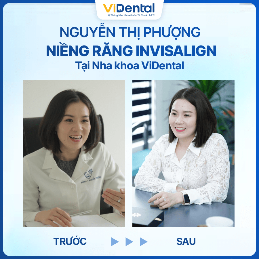 Khách hàng Nguyễn Thị Phượng - Khách hàng tại Nha Khoa ViDental