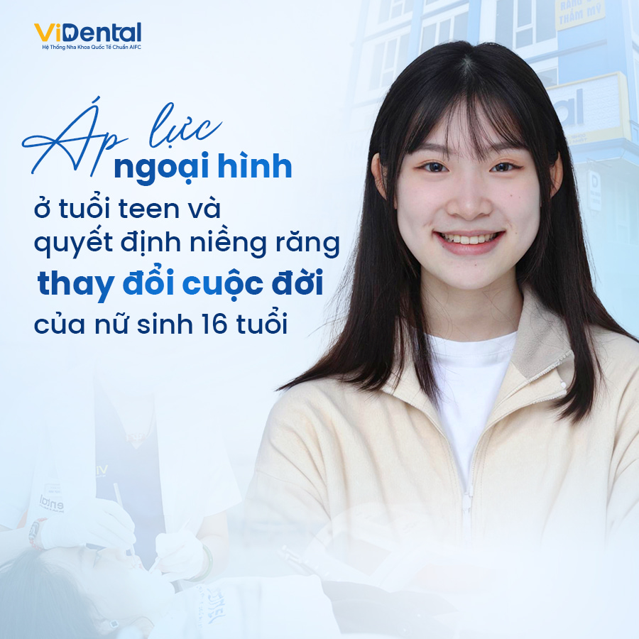 Hành trình niềng răng của Hồng Ngọc: Từ tự ti đến tự tin rạng rỡ - Khách hàng tại Nha Khoa ViDental